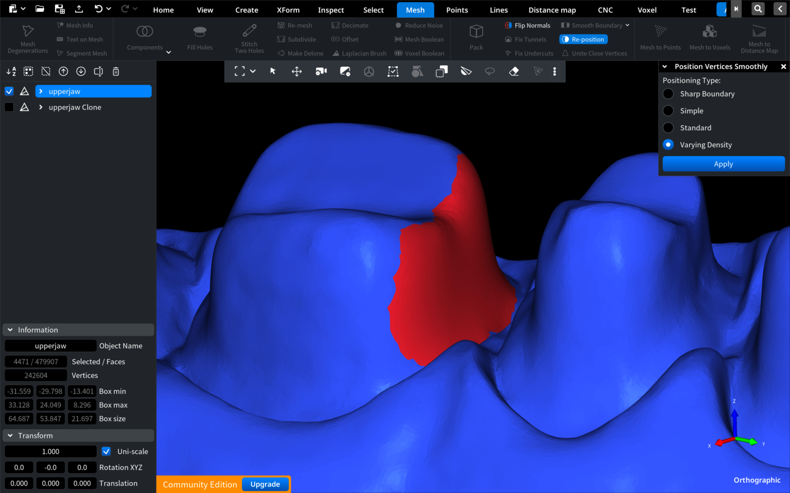 Digital Dentistry - MeshInspector