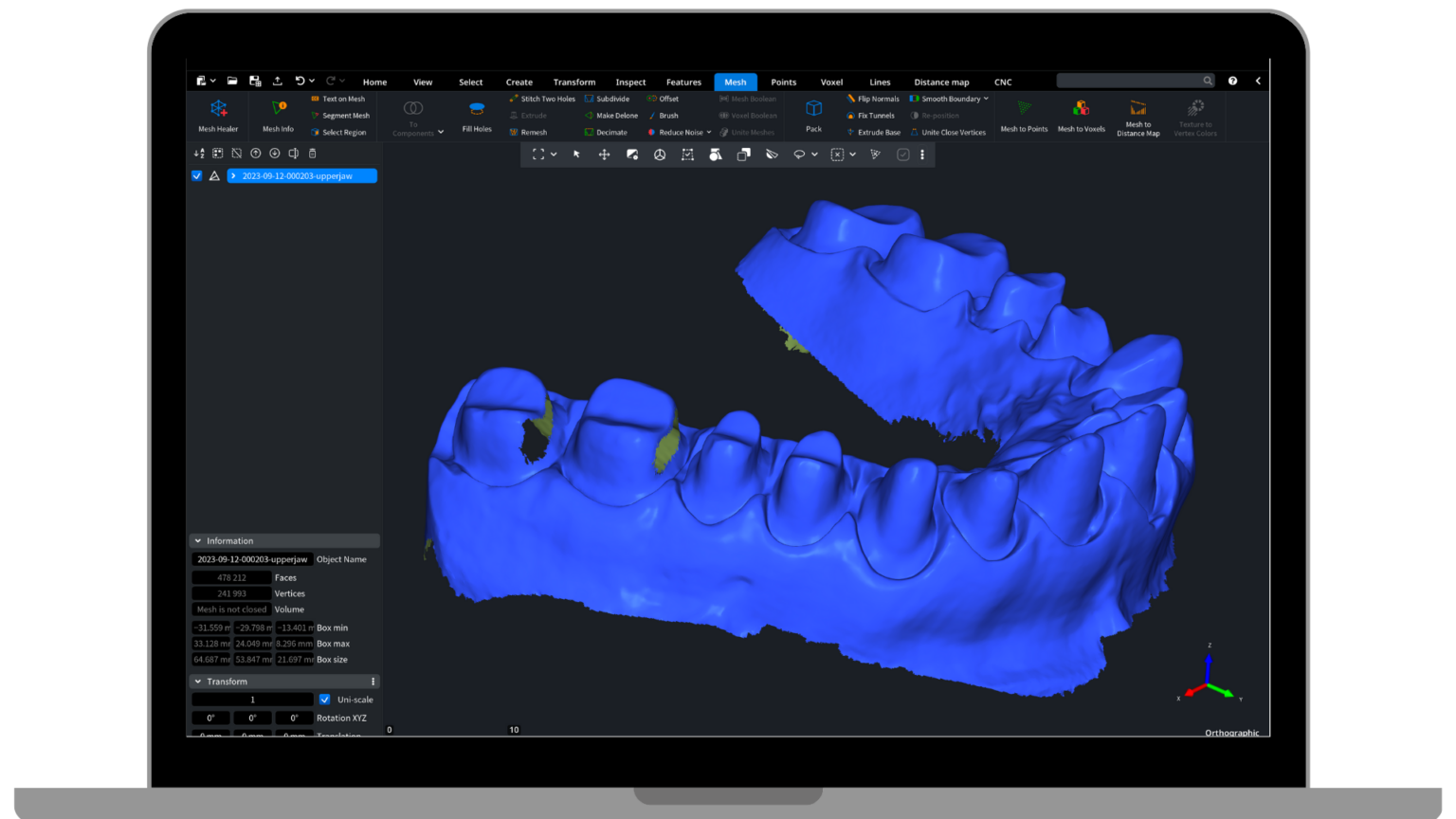 Digital Dentistry - MeshInspector