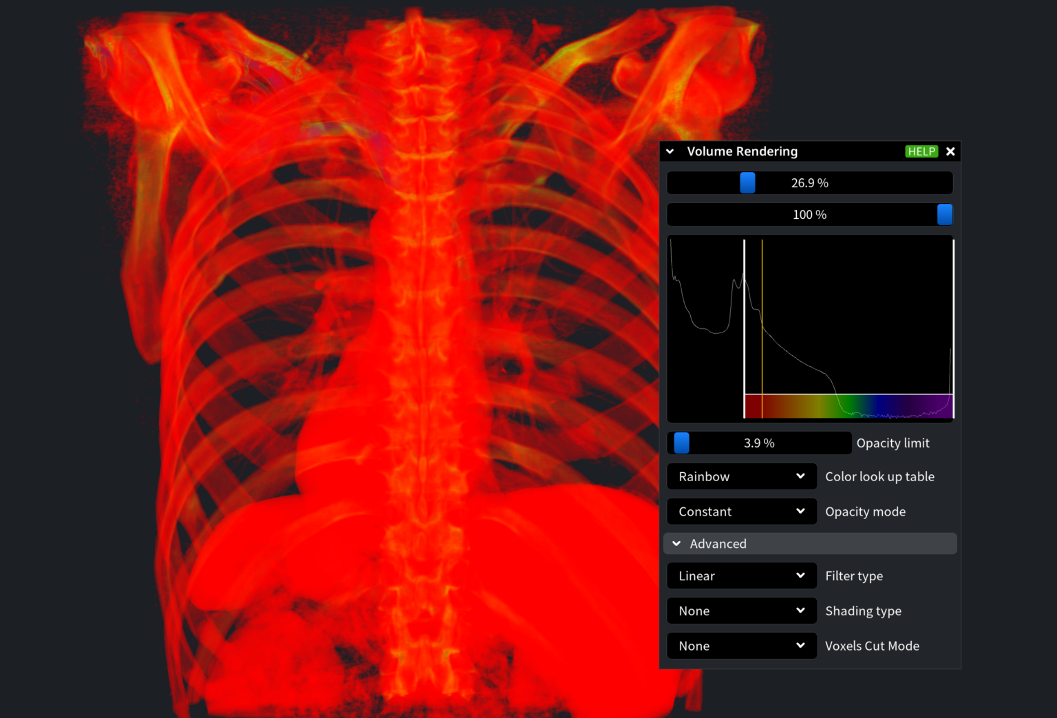 DICOM viewer - MeshInspector